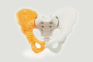 Engineered Tissue Scaffolds - Onealexanews.com