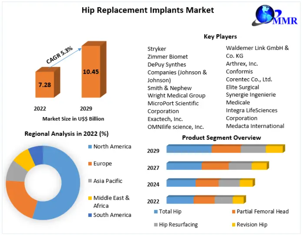 Hip Replacement Implants Market Unveiling Opportunities and Trend ...